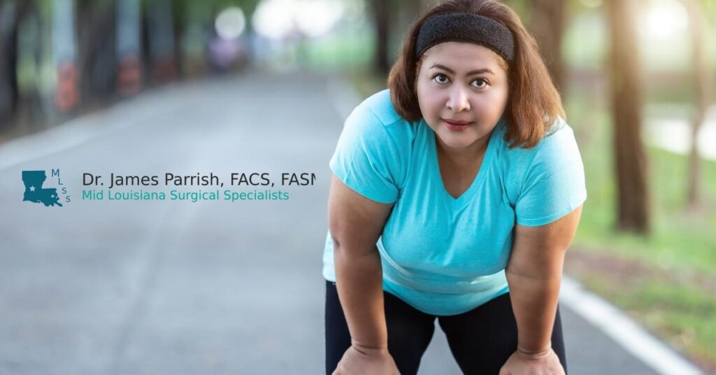 GERD Surgery for Acid Reflux Alexandria Natchez LA